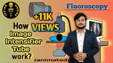 Image Intensifier Tube Labeled At Rebecca Patrick Blog