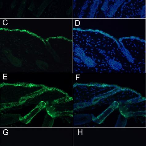 Increased Apoptosis And Keratinocyte Proliferation In Mouse Skin Download Scientific Diagram