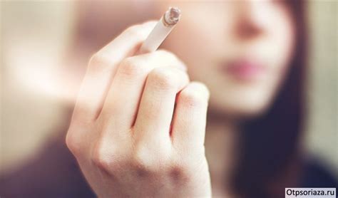 Псориаз на локтях фото симптомы и лечение в домашних условиях