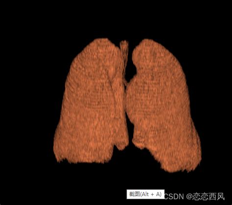 三维重建 阈值分割 3d可视化 医学图像分割 Ct图像分割及重建系统 可视化编程技术及应用3d医学图像阈值处理 Csdn博客