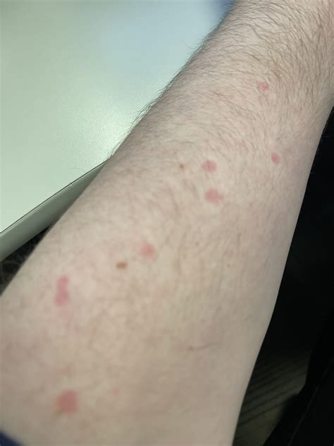 red spots on arm r medical