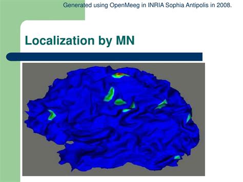 Ppt Cortical Source Localization Of Human Scalp Eeg Powerpoint