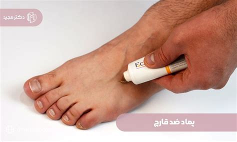 پماد ضد قارچ، راهی نوین برای درمان عفونت‌ها کلینیک ارتوپدی تخصصی فوق تخصصی