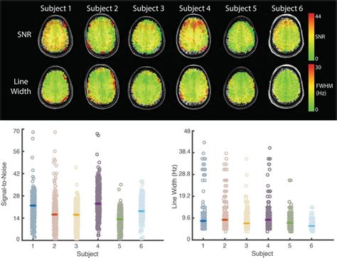 Spatial Distribution Of Signal To Noise Ratio And Line Width Across The