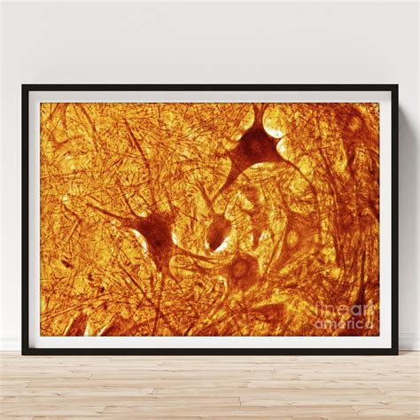 Spinal Cord Multipolar Neurons 2 Art Print By Jose Calvo Science Photo Library Science