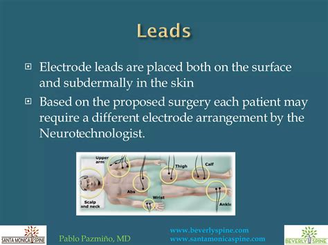 Intraoperative Monitoring Ppt