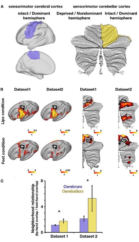 Different Overlap Relationships Of Body Part Activations Between The