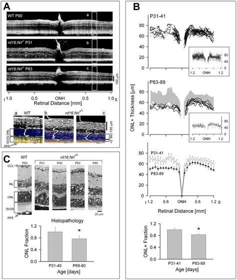 Oct Abnormalities In Rd16 Nrl 2 2 Mice A Upper Panels Download
