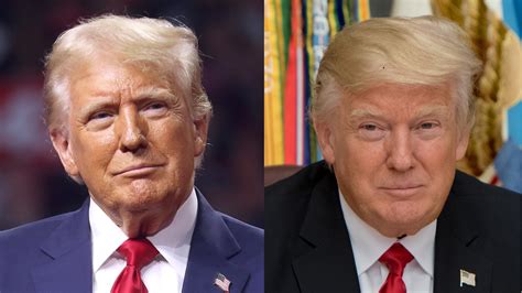 Is Us President Donald Trump Getting A Double Hip Replacement Surgery Health And Me