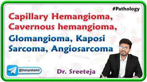 4 Capillary Hemangioma Cavernous Hemangioma Glomangioma Kaposi