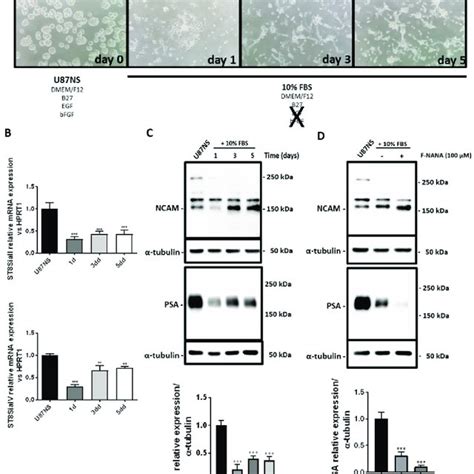 Ncam And Psa Expression In Different Gbm Cell Cultures And Hypoxic