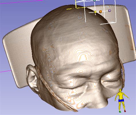 调正CT片 问题求助 DSlicer中文论坛