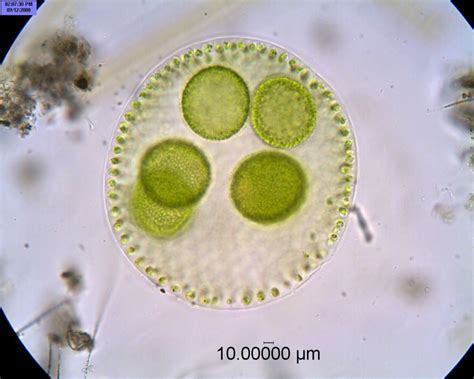 Volvox Under Microscope