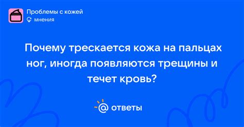 Почему трескается кожа на пальцах ног иногда появляются трещины и