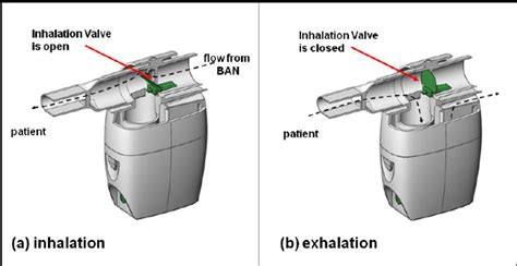 Aerobika Opep Device Air Flow Pathways During Complete Tidal Breathing Download Scientific