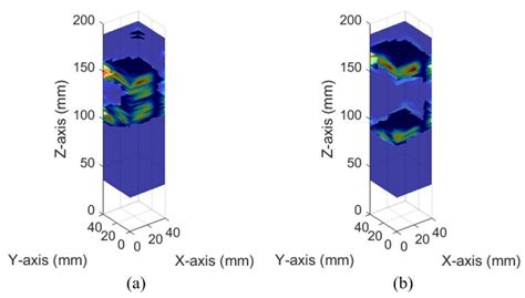 Forward Looking Ultrasound Wearable Scanner System For Estimation Of