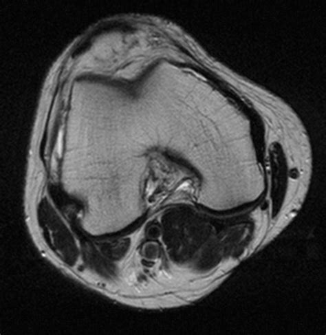 Lower Extremities 7 Diagram Quizlet