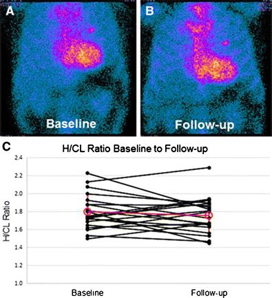 Serial MTc PYP Scintigraphy Scanning For Cardiac Transthyretin Download Scientific Diagram