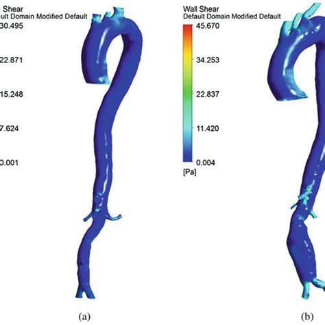 Mesh Sensitivity Test For Aneurysmal Aorta Model Download Scientific Diagram