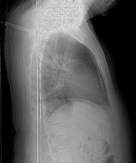 Mendelson Dds At James Ivery Blog