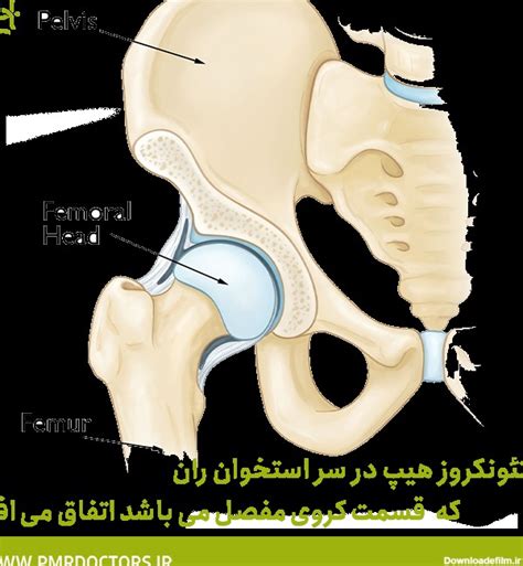عکس سیاه شدن استخوان پا