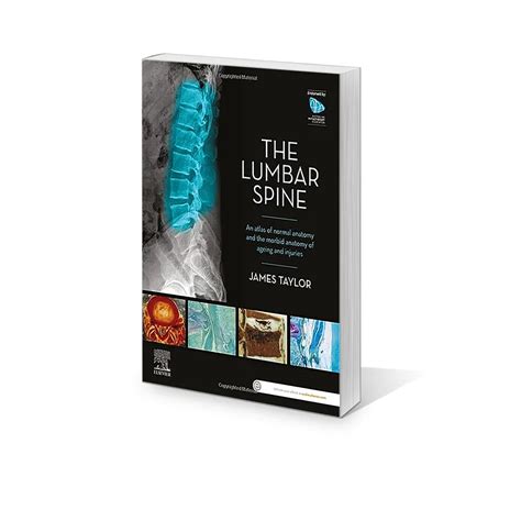 The Lumbar Spine An Atlas Of Normal Anatomy And The Morbid Anatomy Of