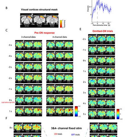 A Averaged On Off Time Frequency Spectrograms During The Fixed Download Scientific Diagram