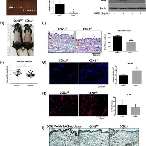 Pdf Ccn1 Expression By Fibroblasts Is Required For Bleomycin Induced