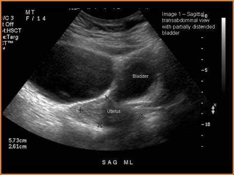 Radiological Category Ultrasound Principal Modality 1 Ultrasound Principal