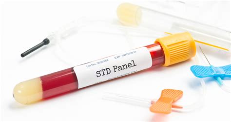 Syphilis Stages Testing And Importance Of Early Diagnosis