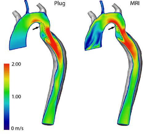 Comparison Of Velocity Magnitude Distributions In A Cross Sectional