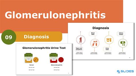 Download Glomerulonephritis Powerpoint Template Rxslides