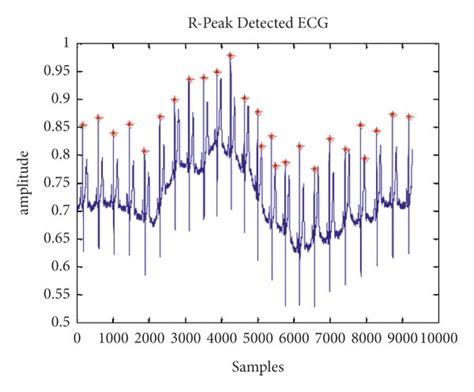 R Peak Identified Of Record No Of ECG Signal Download Scientific Diagram