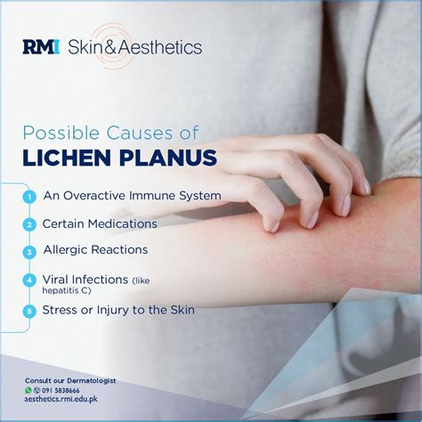 Lichen Planus Causes Symptoms And How To Manage Rehman Medical