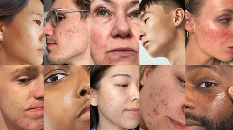 Various Skin Issues Causes Symptoms And Effective Treatment