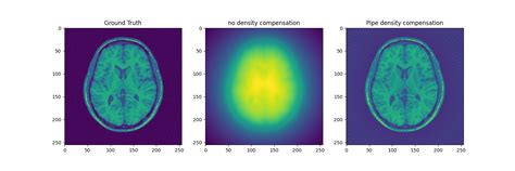 Density Compensation Routines — Mri Nufft Documentation