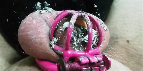 My Tiny Dick Lock In Chastity Being Burned By Cigarettes No Penis It Is