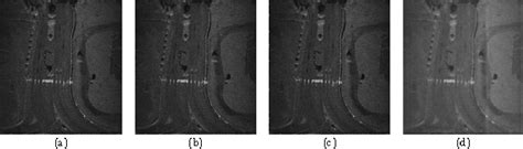 Figure From A SAR Image Denoising Method For Target Shadow Tracking Task Semantic Scholar