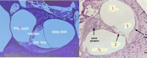 Anatomy Lab Final Practical Flashcards Quizlet