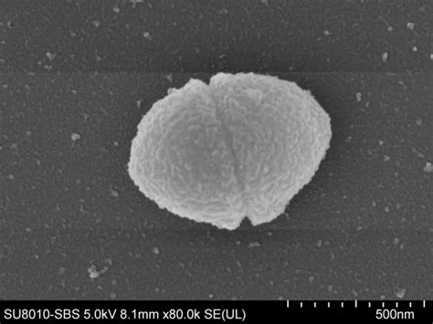 Streptococcus Anginosus [image] Eurekalert Science News Releases