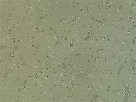 Enterococcus Avium Introduction Morphology Pathogenicity Lab