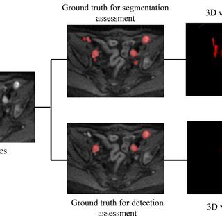Imaging Protocols Of The Pelvis DWI Sequences Download Scientific Diagram