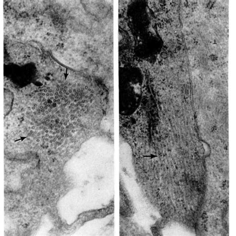 Electron Micrograph Of Part Of Similar Embryo To One Shown In Fig 3 Download Scientific