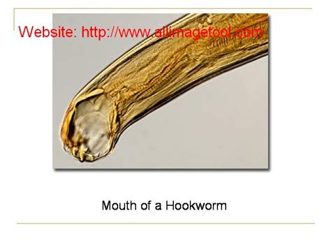 Dr Moins Blog Ancylostomiasis