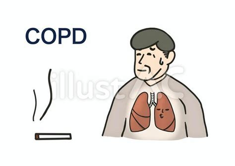 人間 症状 Copd 男性イラスト No 1457881／無料イラストフリー素材なら「イラストac」