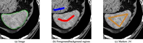 Figure 1 From Parameter Free Selective Segmentation With Convex Variational Methods Semantic