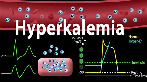 How To Manage Common Medical Problems Hyperkalemia Stepwards