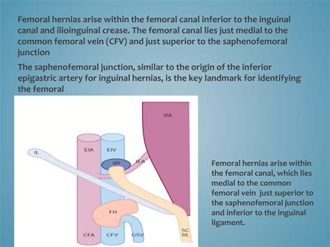 Ultrasoud Hernia Pptx