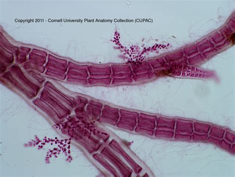 Polysiphonia Slide Labeled A Mini Guide For How To Tell Apart Two