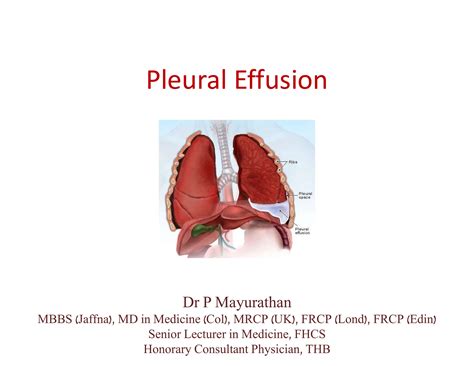 Pleural Effusion And Its Pathophysiology Pdf